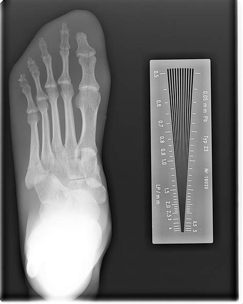Effect Of Pixel Size On Resolution Radiology Suny Upstate