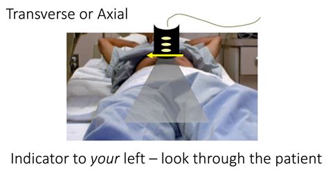 Ultrasound Basics Transverse Plane