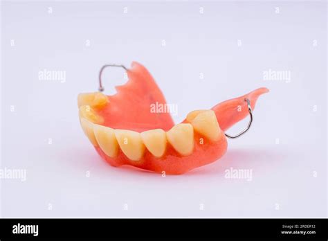 Removable Denture Of An Upper Jaw Denture Dental Prosthesis Dentist