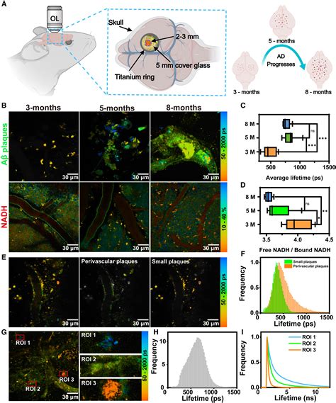 Polarity Responsive Fluorescence Lifetime Probe For In Vivo Imaging Of Aβ Plaque Dynamics
