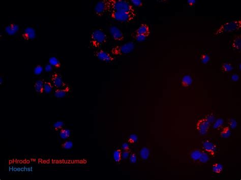 Chris Langsdorf On Linkedin Three Things To Know About The New Phrodo