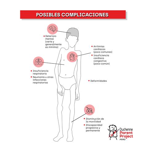 Distrofia Muscular De Duchenne Dmd En El Perú