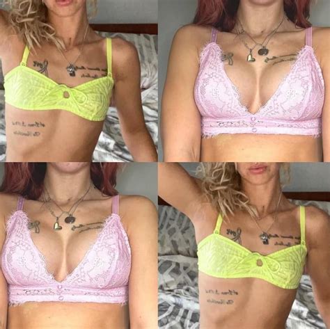 Breast Implant Size Guide Enhance Medical