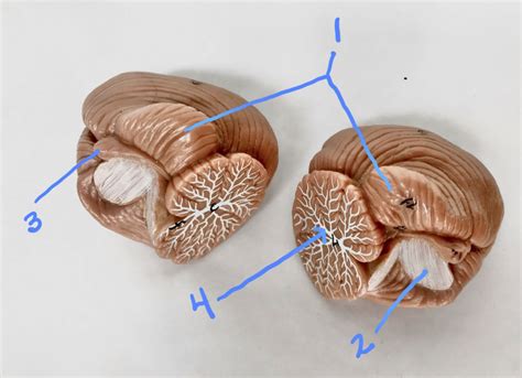 Metencephalon Diagram Quizlet