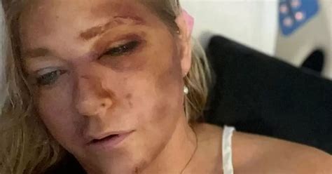 Prince Andrew Sex Accuser Virginia Giuffre Hits Back At Police In