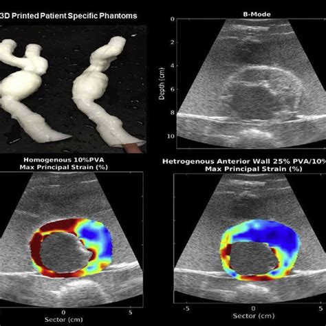 Fig Three Dimensional Printed Patient Specific Phantoms Left