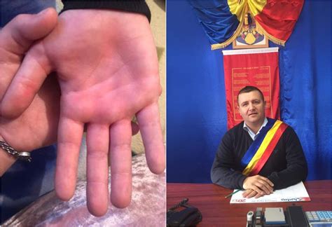 Detalii șocante în Cazul învățătorului Care A Bătut Un Copil Un Primar Din Vaslui îi Ia Apărarea