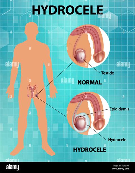Healthy Testicles Size