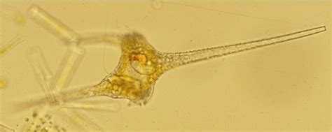 Algae Deck Chrysophyta Cryptophyta Euglenophyta Xanthophyta And Dinoflagellates Flashcards