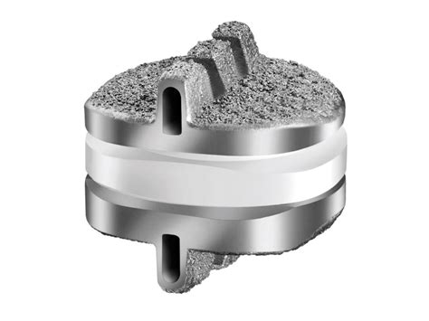 Interbody Spacers Archives International