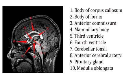 Mri Of Brain Ct Scan And Mri