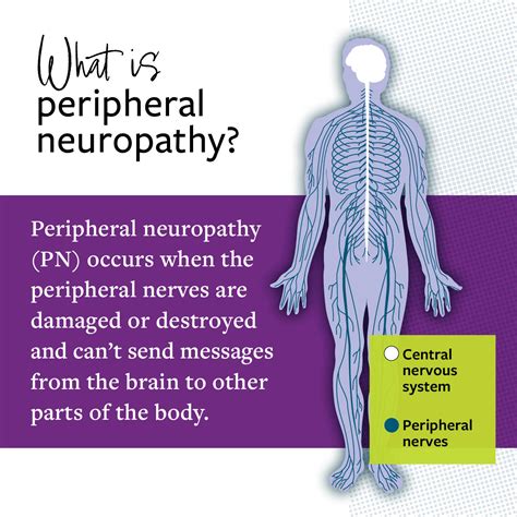 The Foundation For Peripheral Neuropathy Peripheral Neuropathy Pn Occurs When The Peripheral