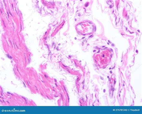 Histology Of Human Appendix Micrograph Showing Crypts Of Lieberkuhn Royalty Free Stock