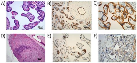 Tissues N 3 Were Successfully Formalin Fixed And Paraffin Embedded