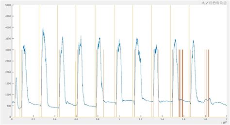 How To Select Only Values That Are Directly Preceded By A Certain Value Rmatlab