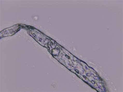 At 10000x The Lyme Pathogen That No One Seems To Know About And He Is