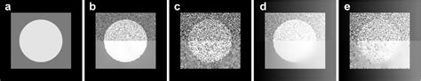 Figure 1 From Breast Ultrasound Despeckling Using Anisotropic Diffusion Guided By Texture