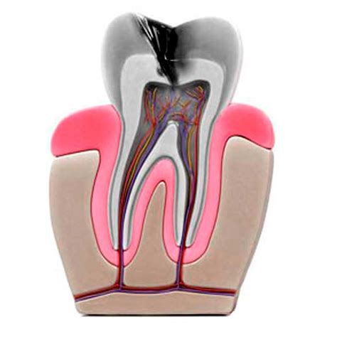 Endodoncia En Bogotá Tratamiento De Conductos Dientes And Sonrisa