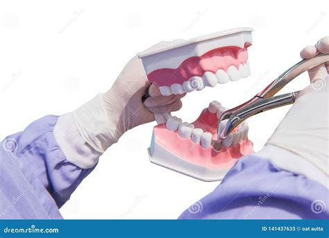 The Dental Model Is Used To Demonstration Of Tooth Extraction By