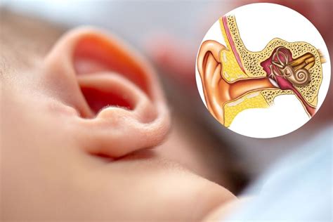 Bebé Que Nació Con Sordera Oye Por Primera Vez Con Innovadora Terapia