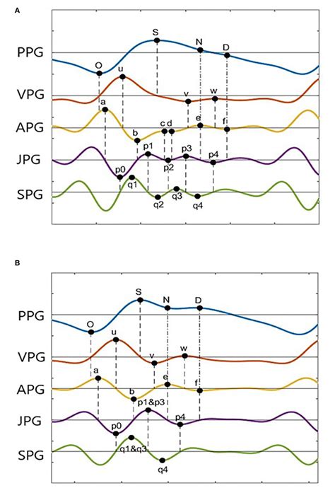 Figure 1 From Analysis On Four Derivative Waveforms Of