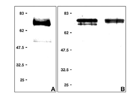 Western Blot Of Protein Extracts Incubated With Atpin A Major 70 Kda