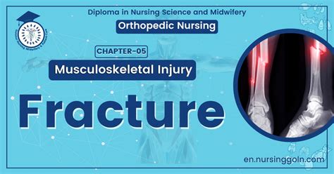 Medical Definition Of Fracture Chapter 5 Orthopedic Nursing