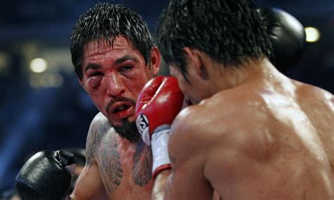 El Día Que Manny Pacquiao Dejó Irreconocible A Margarito Tras Burlarse