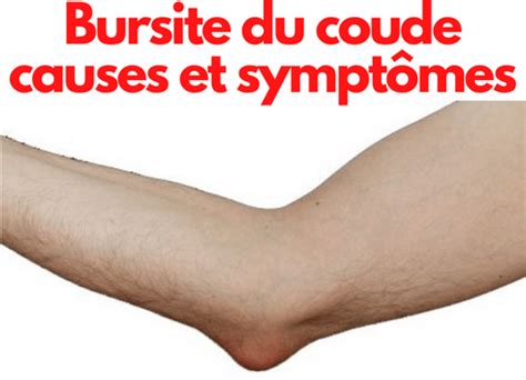 Bursite Coude Solution Et Traitement 100 Naturel Et Bio