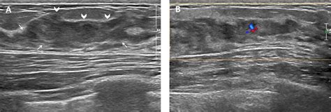 Sonographic Images A Sonography Reveals An Irregular Shaped