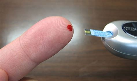 How To Test For Syphilis Best Syphilis Test Online And Std Home Testing