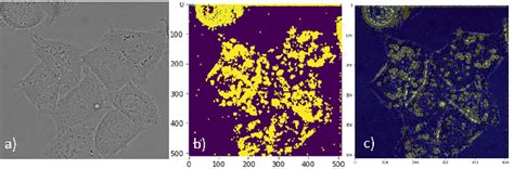 Figure 8 From Deep Learning Based Bio Medical Image Segmentation Using Unet Architecture And