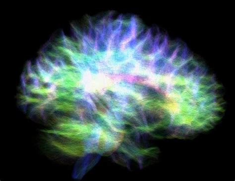 Most Detailed Map Of Brains Memory Hub Finds Connectivity Puzzle