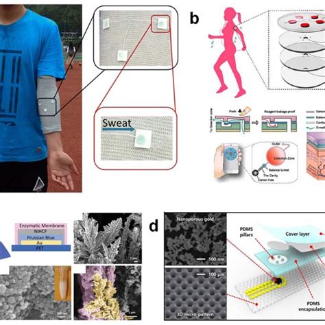 A A Wearable Microfluidic Cotton Threadpaper Based Device Linked To