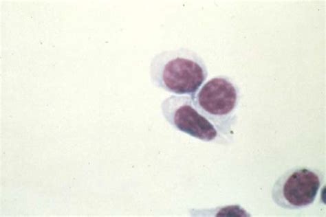 Csf Cells Practical 1 Flashcards