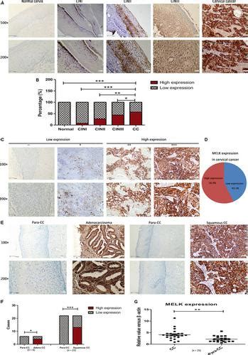 孕产妇胚胎亮氨酸拉链激酶：一种新型的生物标志物和宫颈癌的潜在治疗靶点。cancer Medicine X Mol