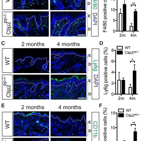 Increased Inflammatory Cell Infiltrate In Ctip2 Ep22 Adult Mice A
