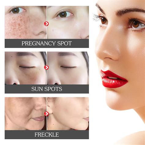 Jaysuing Remove Black Spots Facial Jsky Fade Spots Stain Remove Melanin