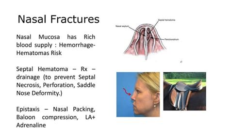 Facio Maxillary Injuries Pptx First Aid Injuries