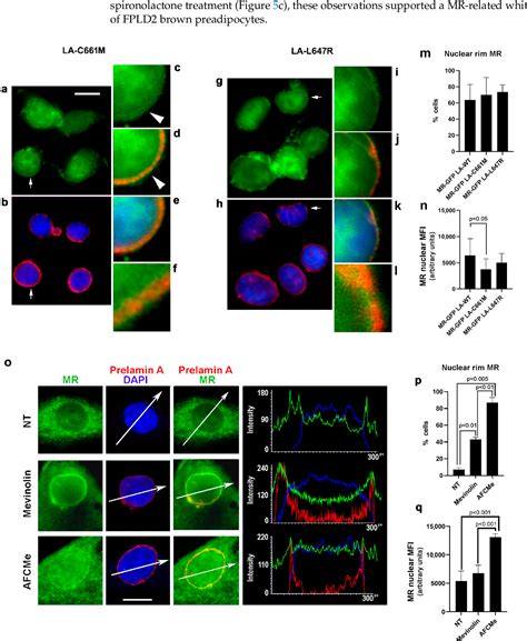 Figure 1 From Mineralocorticoid Receptor Antagonism Prevents Type 2