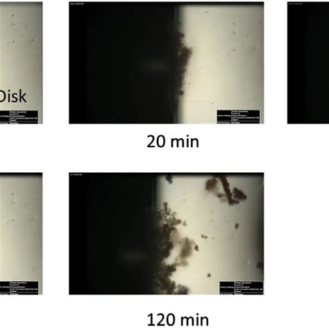 Digital Microscope Image Of Debris Generation From Cocrmo Pin And Disk