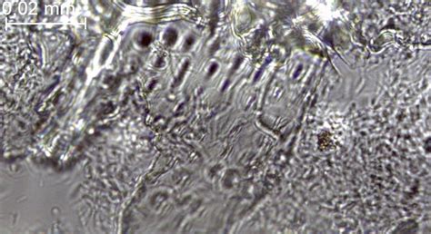 Living Bacteria Sporosarcina Pasteurii On Wooden Surface Download