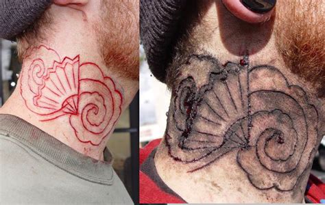 Шрамирование виды и методы [scarification]