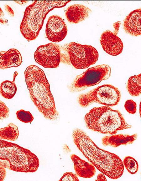 Coxiella Burnetii A Complex Diagnosis Vircell