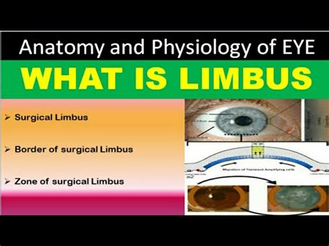Limbus Eye