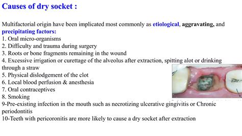 Alveolar Osteitis Dry Socket Pdf