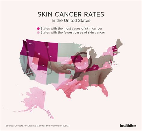 Skin Cancer Graph