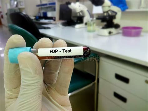 Fdp Fibrin Degradation Product Test Diagnosis Of Coagulation