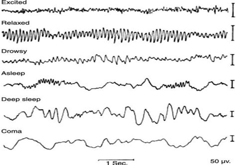 The Electrical Scheme Of The Brain And Associated Arguments The Download Scientific Diagram