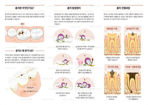 덴탈채널